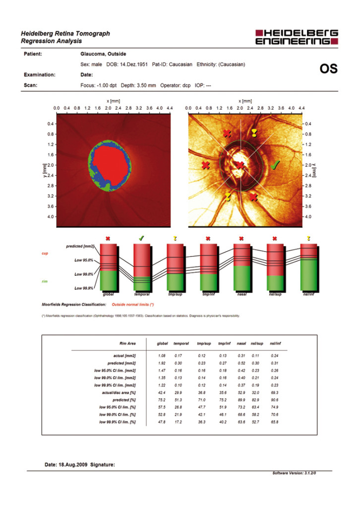 Examinations of the optic nerve head