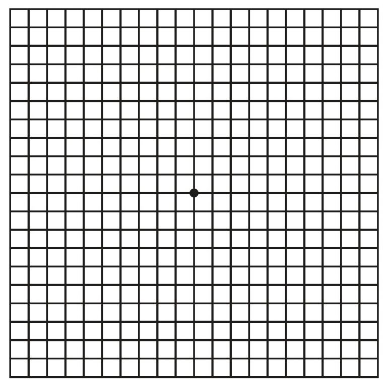 Testing macula function with the Amsler vision test