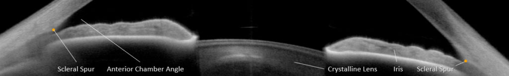 Examinations of the anterior segment of the eye