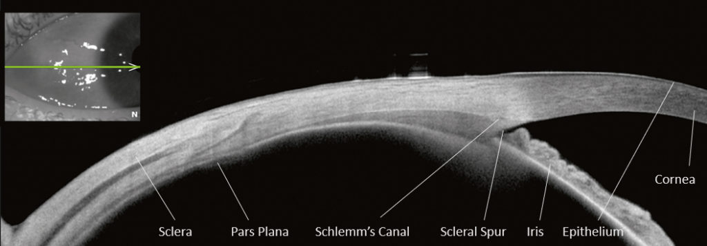 Examinations of the anterior segment of the eye